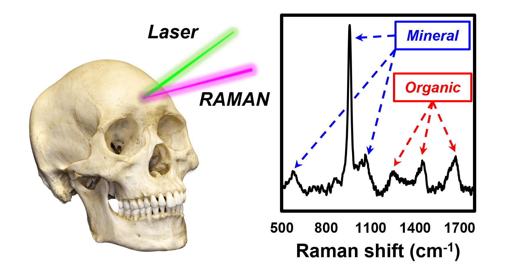 Analysing Bone Composition with Raman Spectroscopy